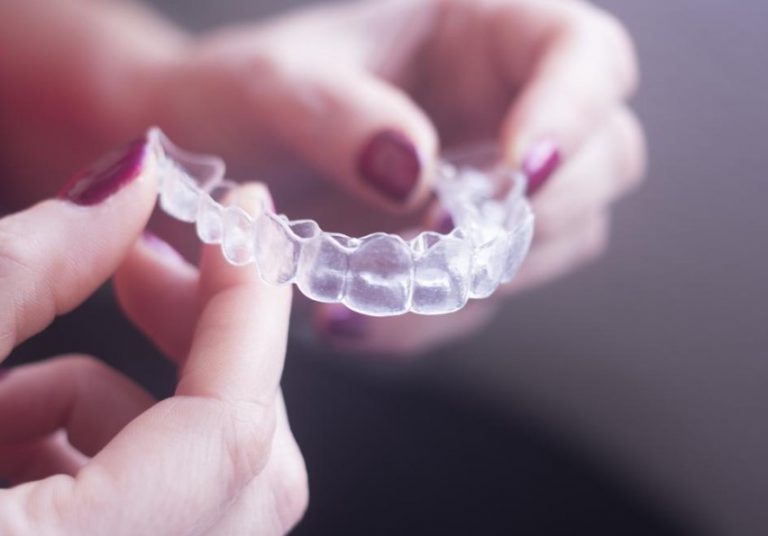 How Invisalign Works - A Comprehensive Guide - Peppard Dental Service